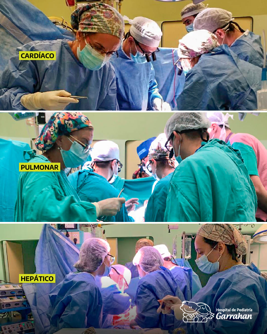 La hazaña del Garrahan: Más de 100 profesionales para un transplante ...