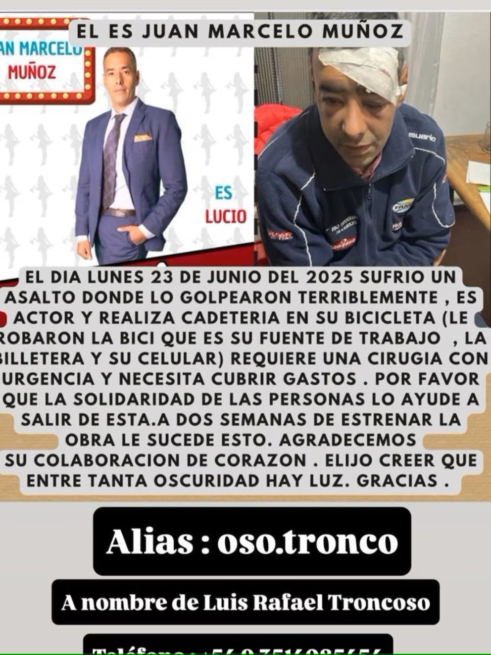 Un actor fue brutalmente golpeado antes de debutar en Carlos Paz: está ...